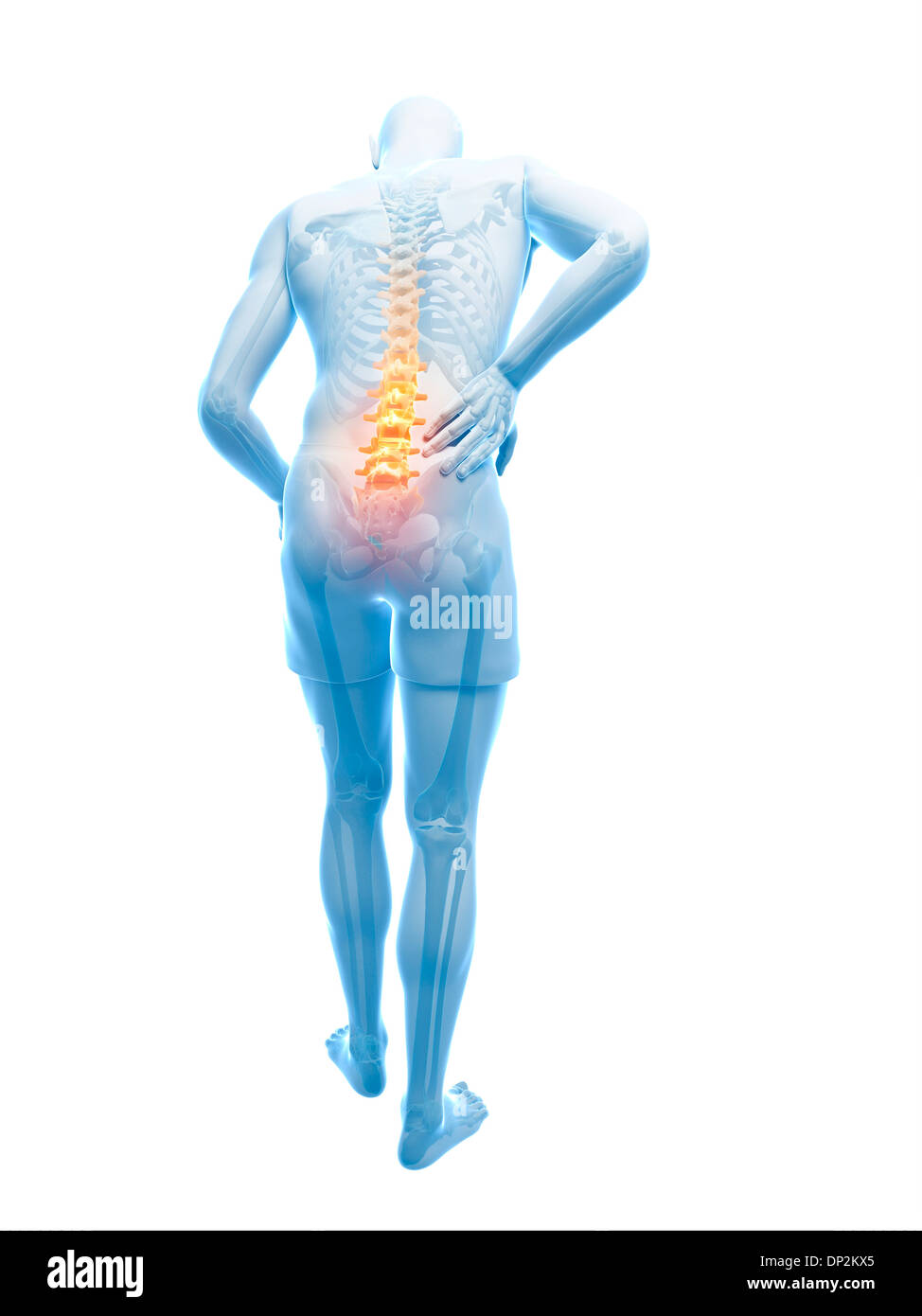 Back pain, artwork Stock Photo - Alamy