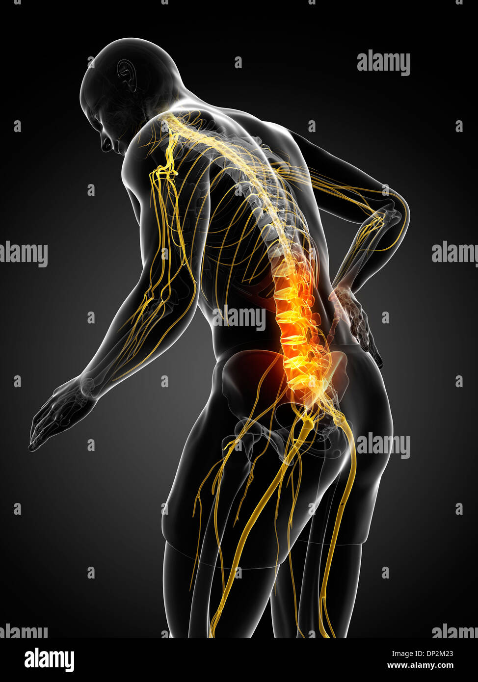 Back pain, artwork Stock Photo - Alamy