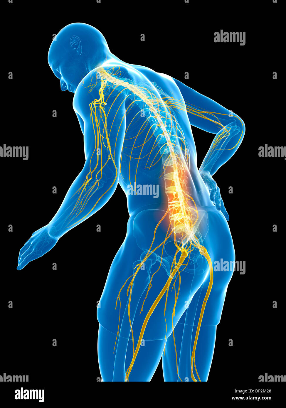 Back pain, artwork Stock Photo - Alamy