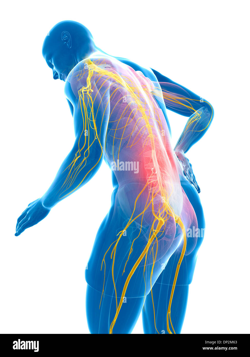 Back pain, artwork Stock Photo - Alamy