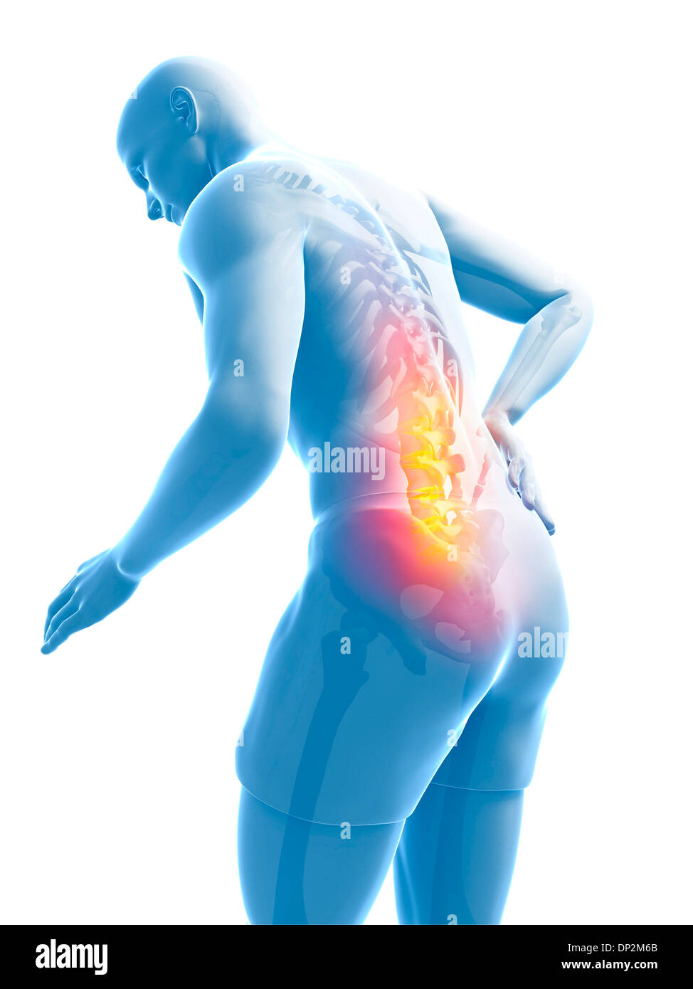 Back pain, artwork Stock Photo - Alamy