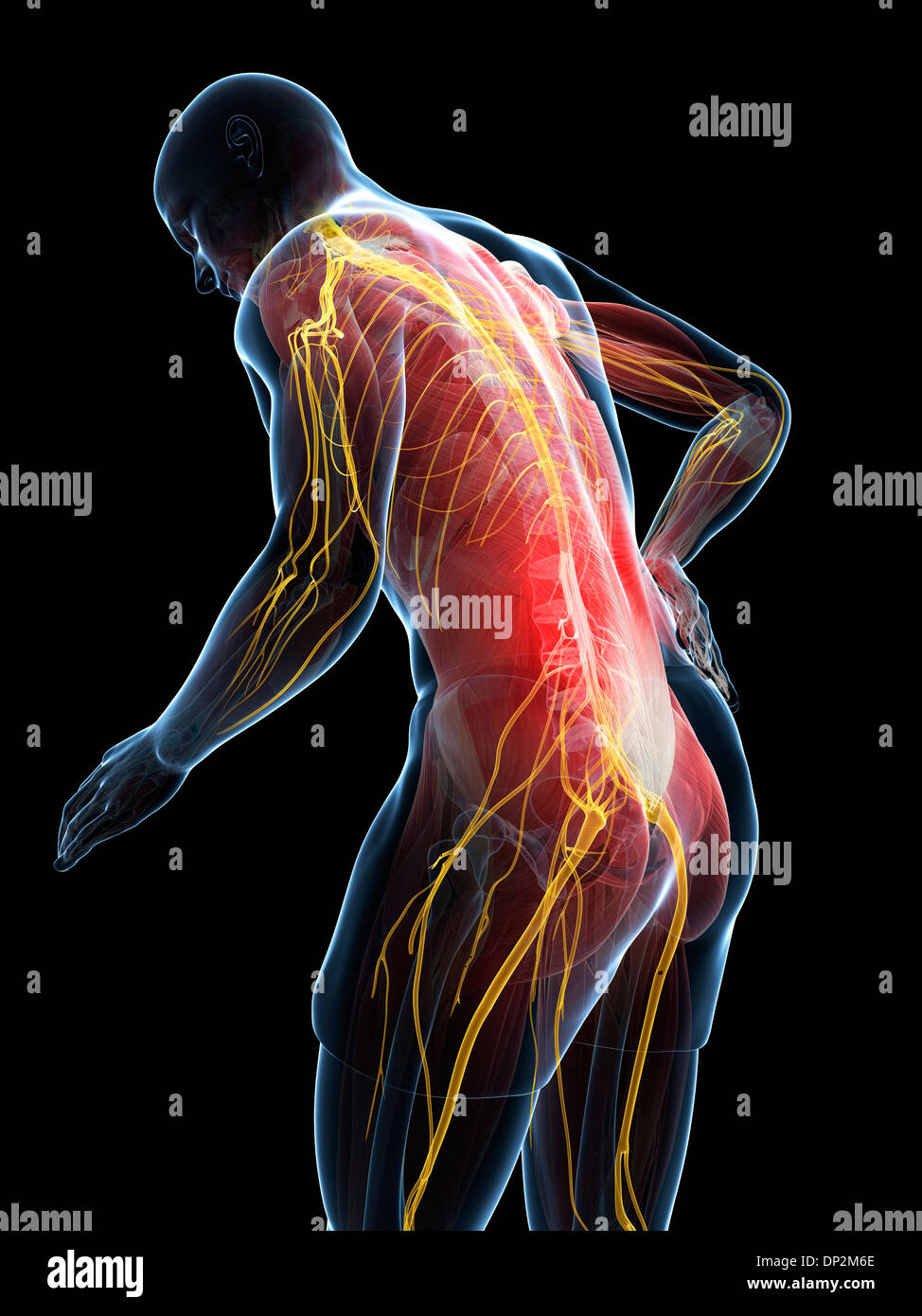 Back pain, artwork Stock Photo - Alamy