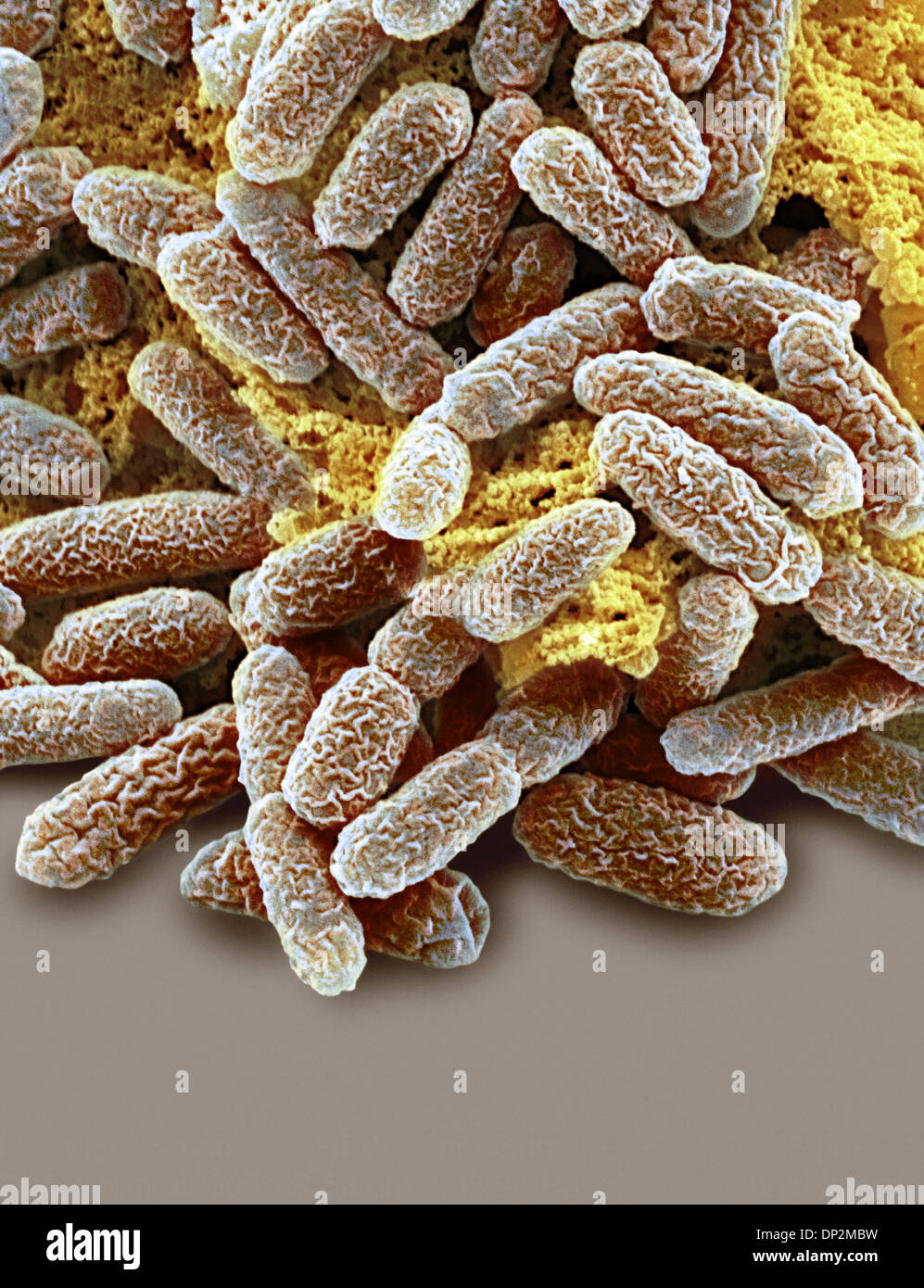 E coli hi-res stock photography and images - Alamy