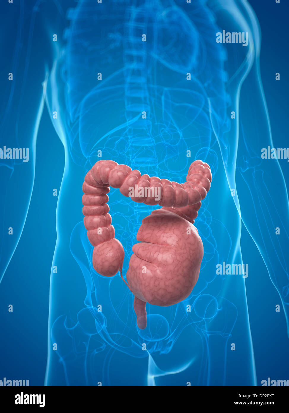 Toxic megacolon, artwork Stock Photo - Alamy