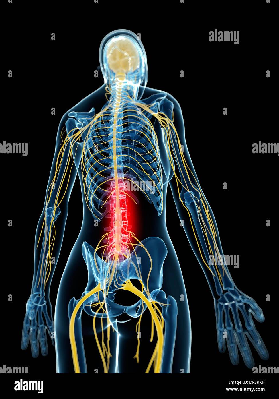 Back pain, artwork Stock Photo - Alamy