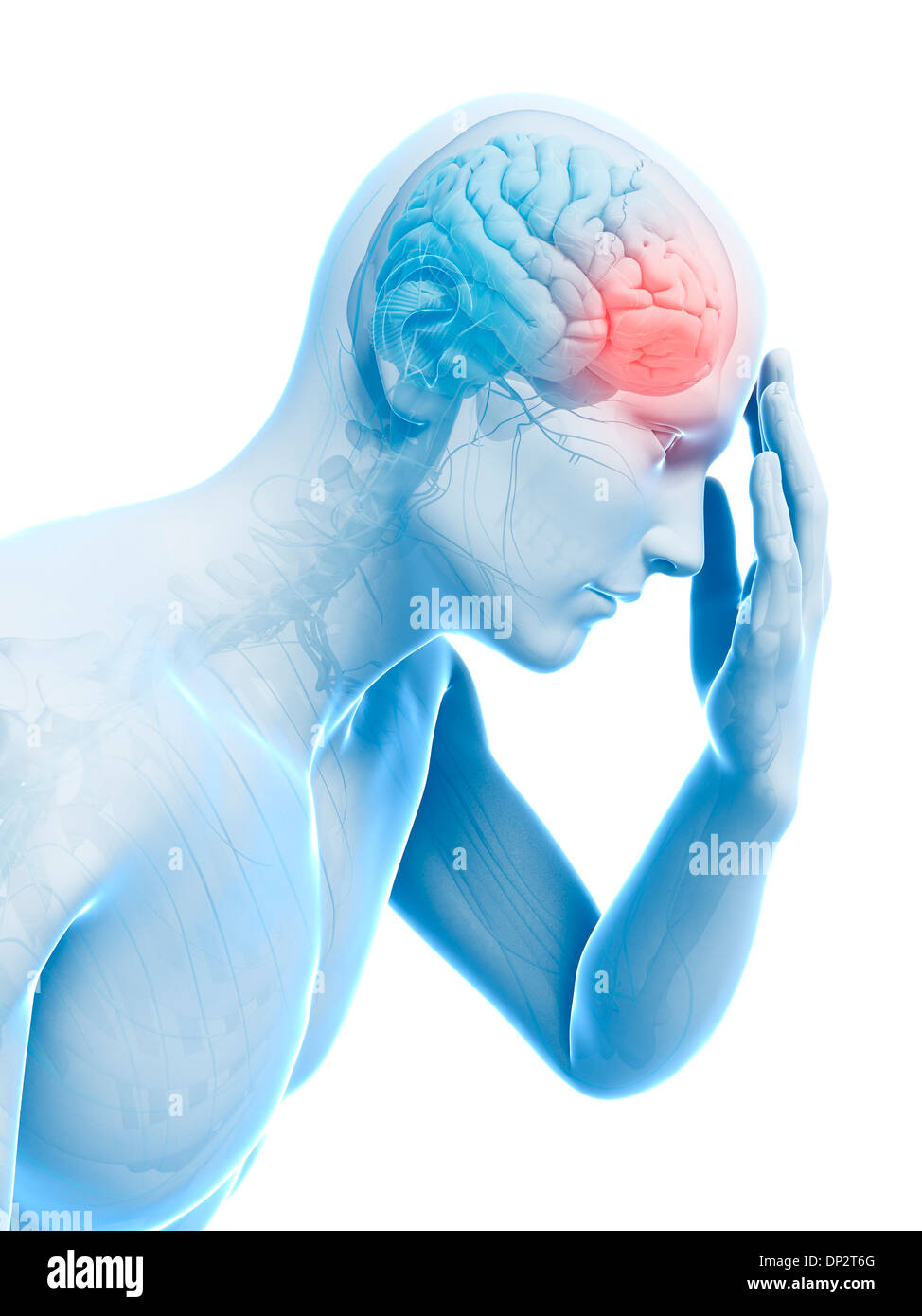 Headache representation hi-res stock photography and images - Alamy