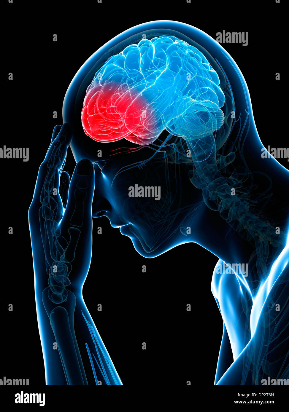 Headache representation hi-res stock photography and images - Alamy