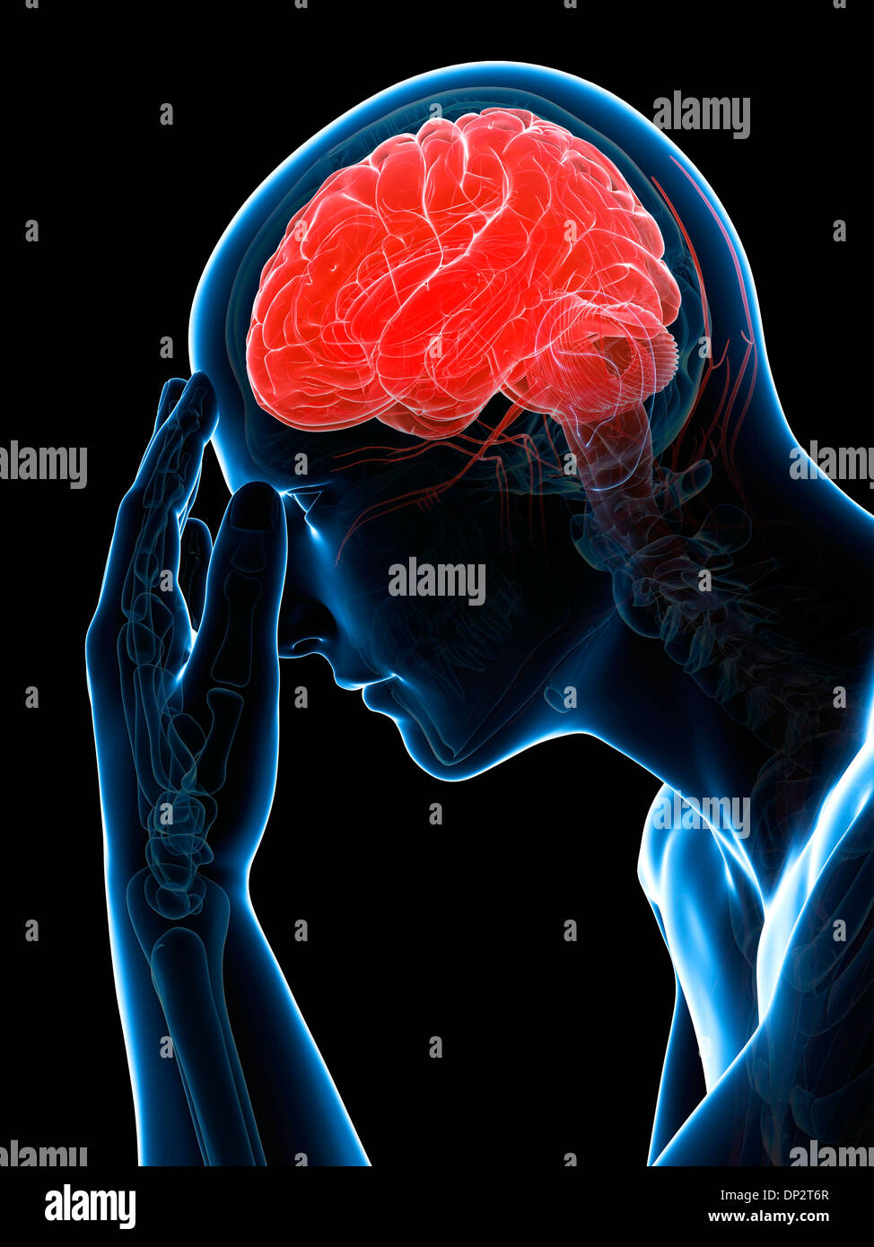 Headache representation hi-res stock photography and images - Alamy