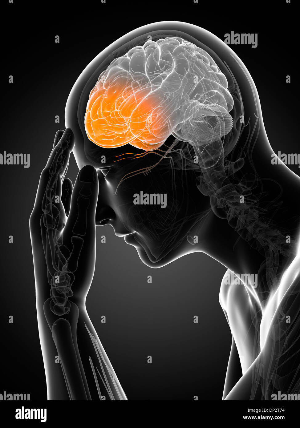 Headache representation hi-res stock photography and images - Alamy