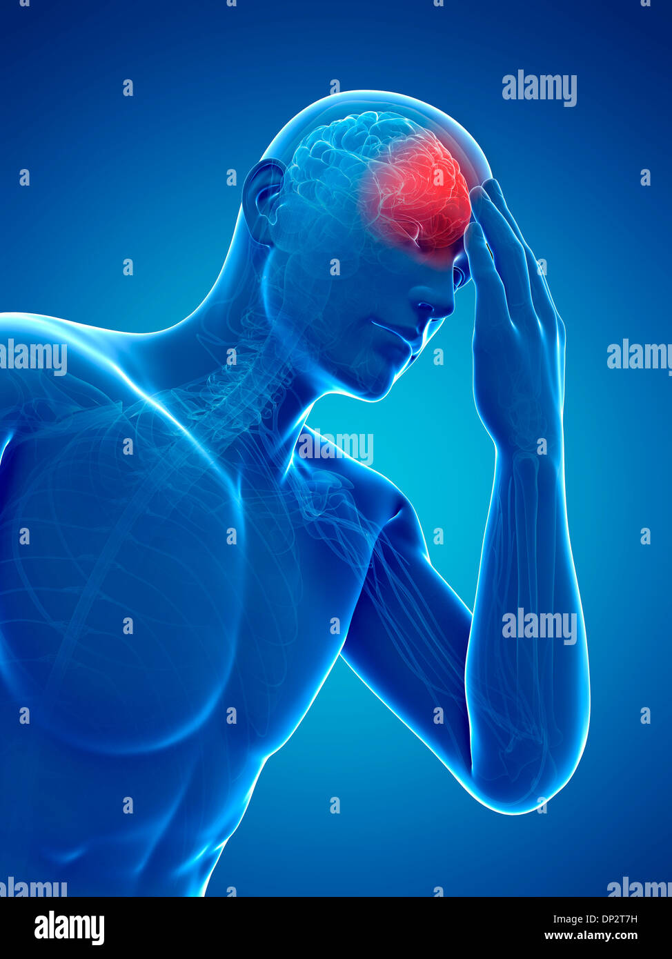 Headache representation hi-res stock photography and images - Alamy
