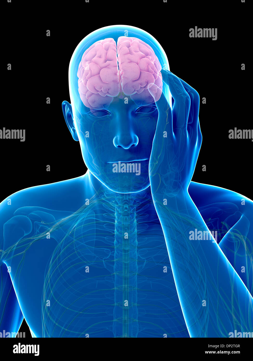 Headache representation hi-res stock photography and images - Alamy