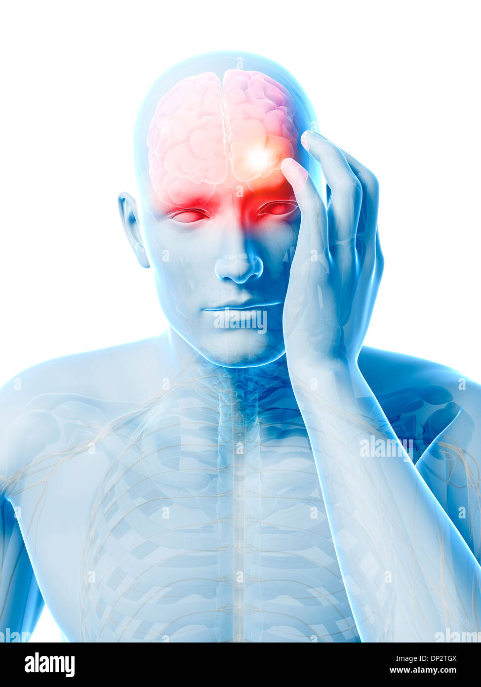 Headache representation hi-res stock photography and images - Alamy