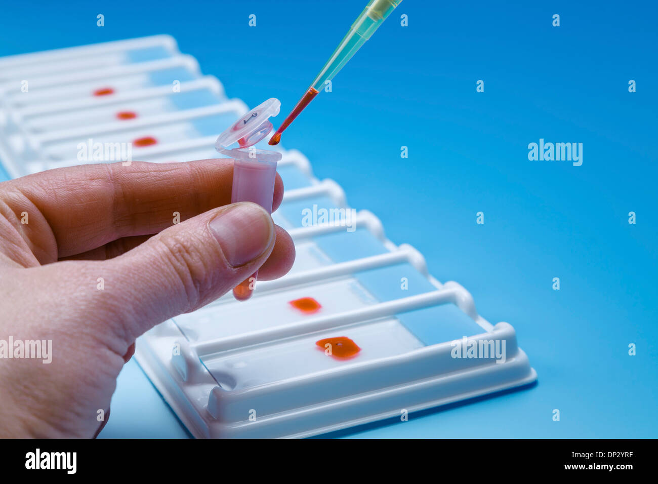 Slide preparation hi-res stock photography and images - Alamy