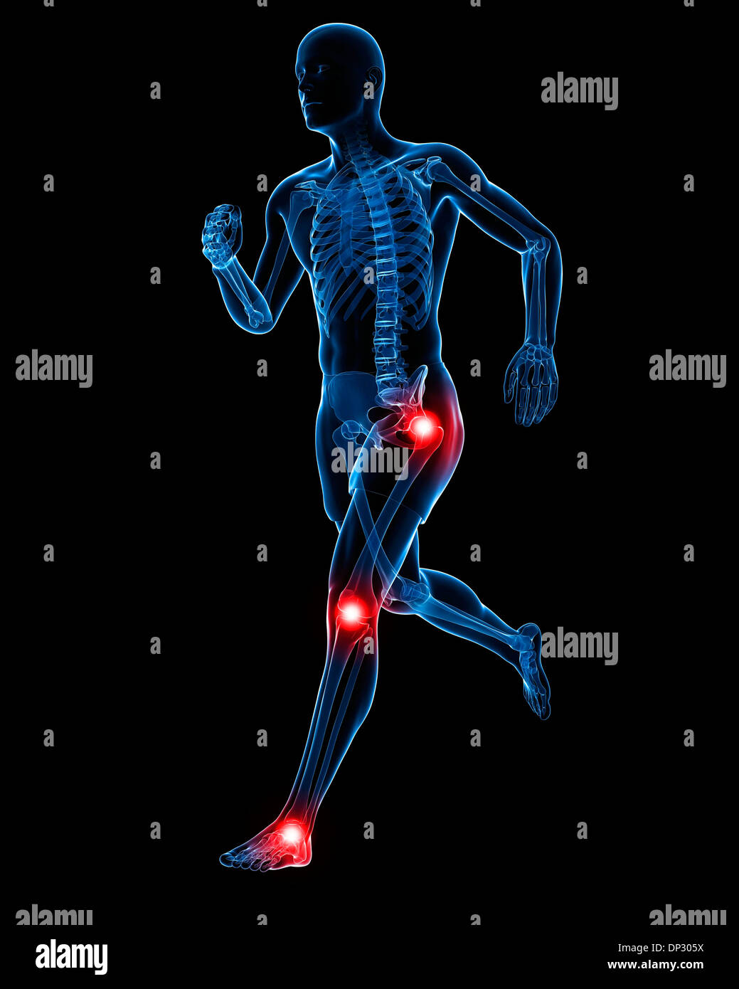 Painful joints, artwork Stock Photo - Alamy