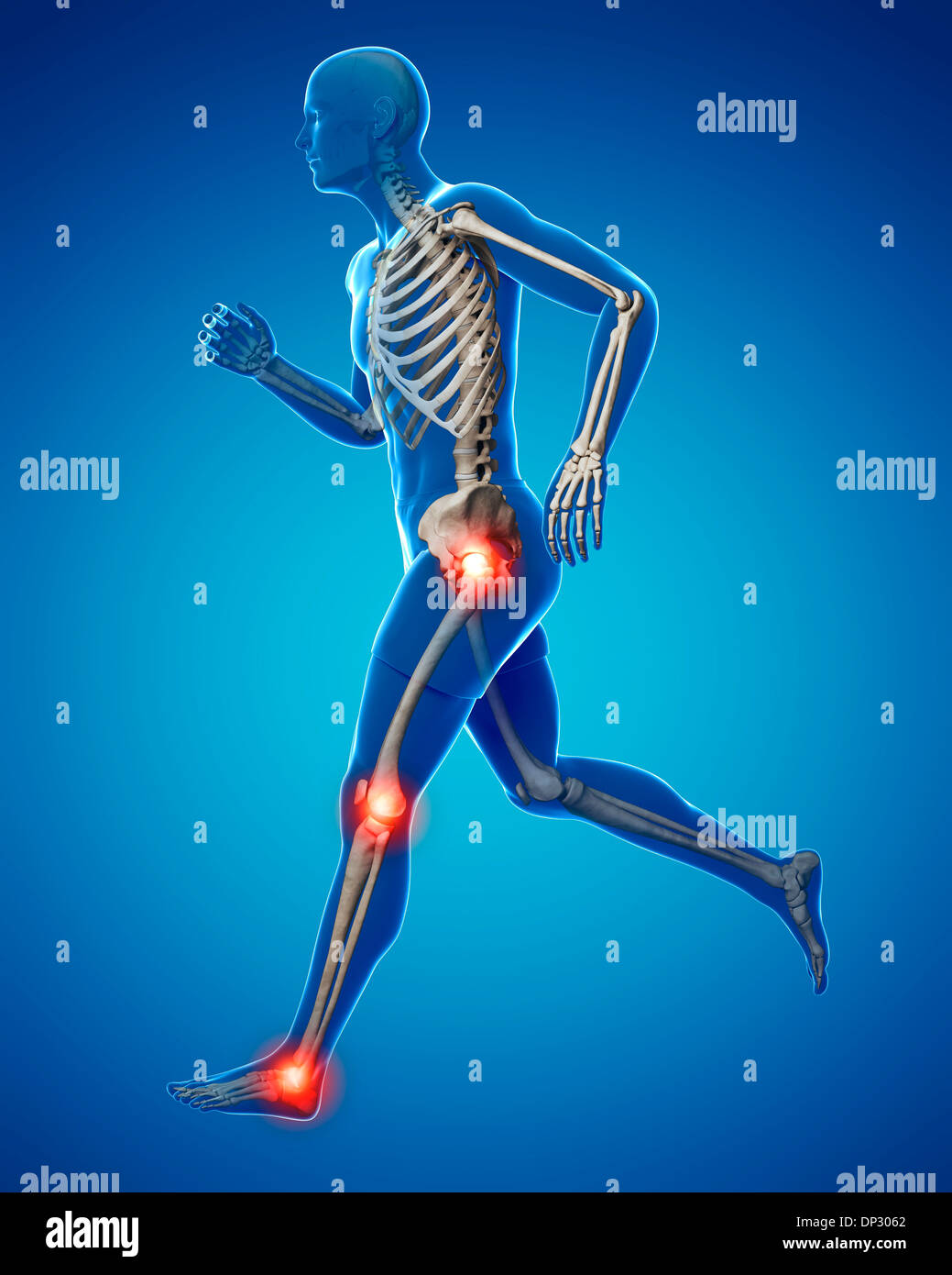 Painful joints, artwork Stock Photo - Alamy
