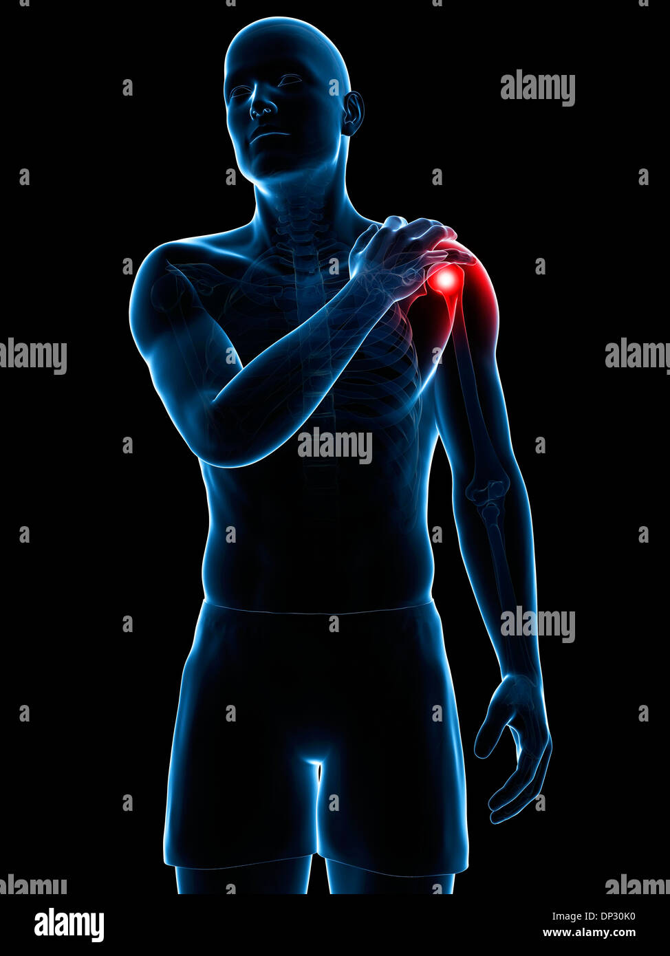 Painful shoulder, artwork Stock Photo - Alamy