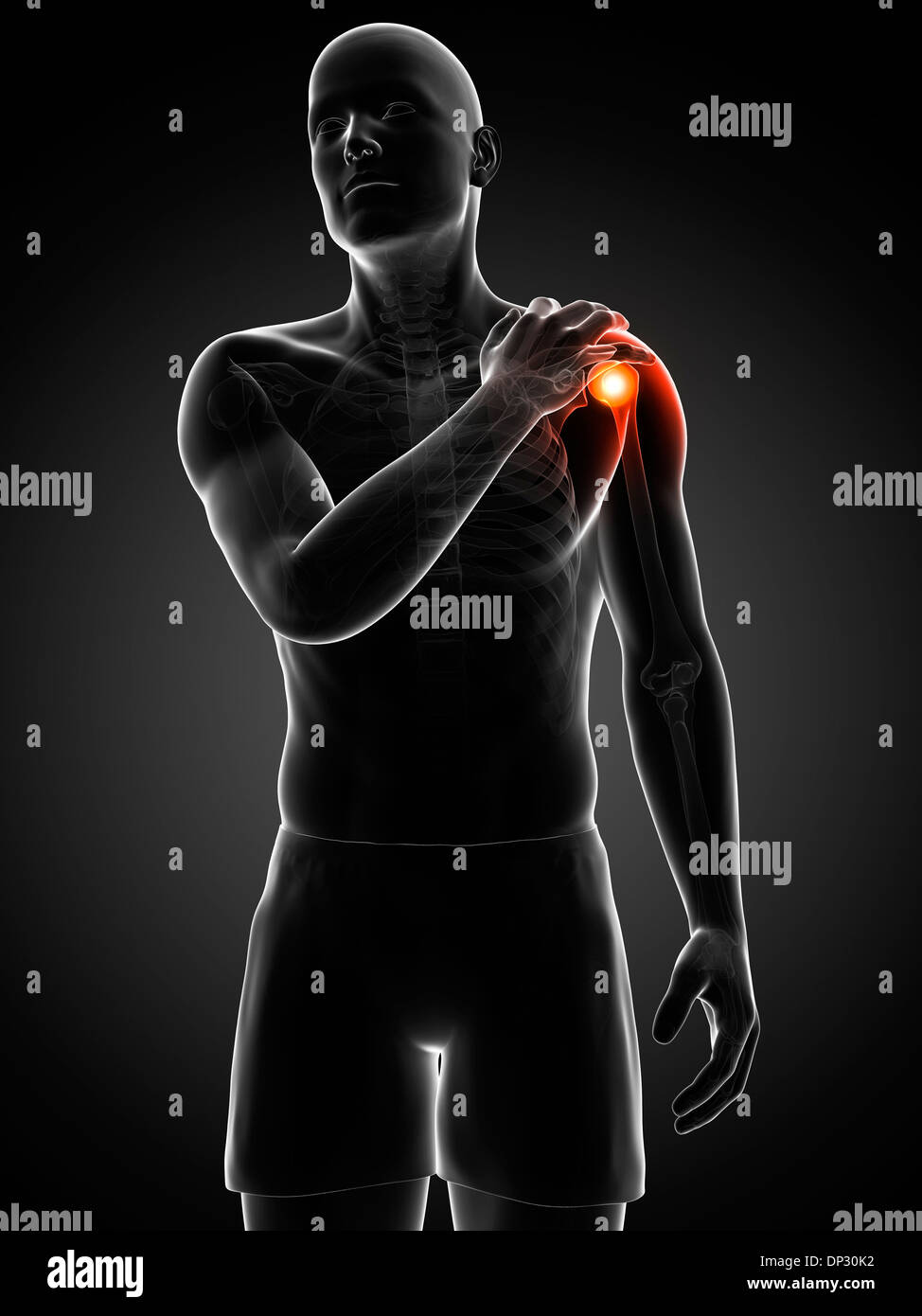 Painful shoulder, artwork Stock Photo - Alamy