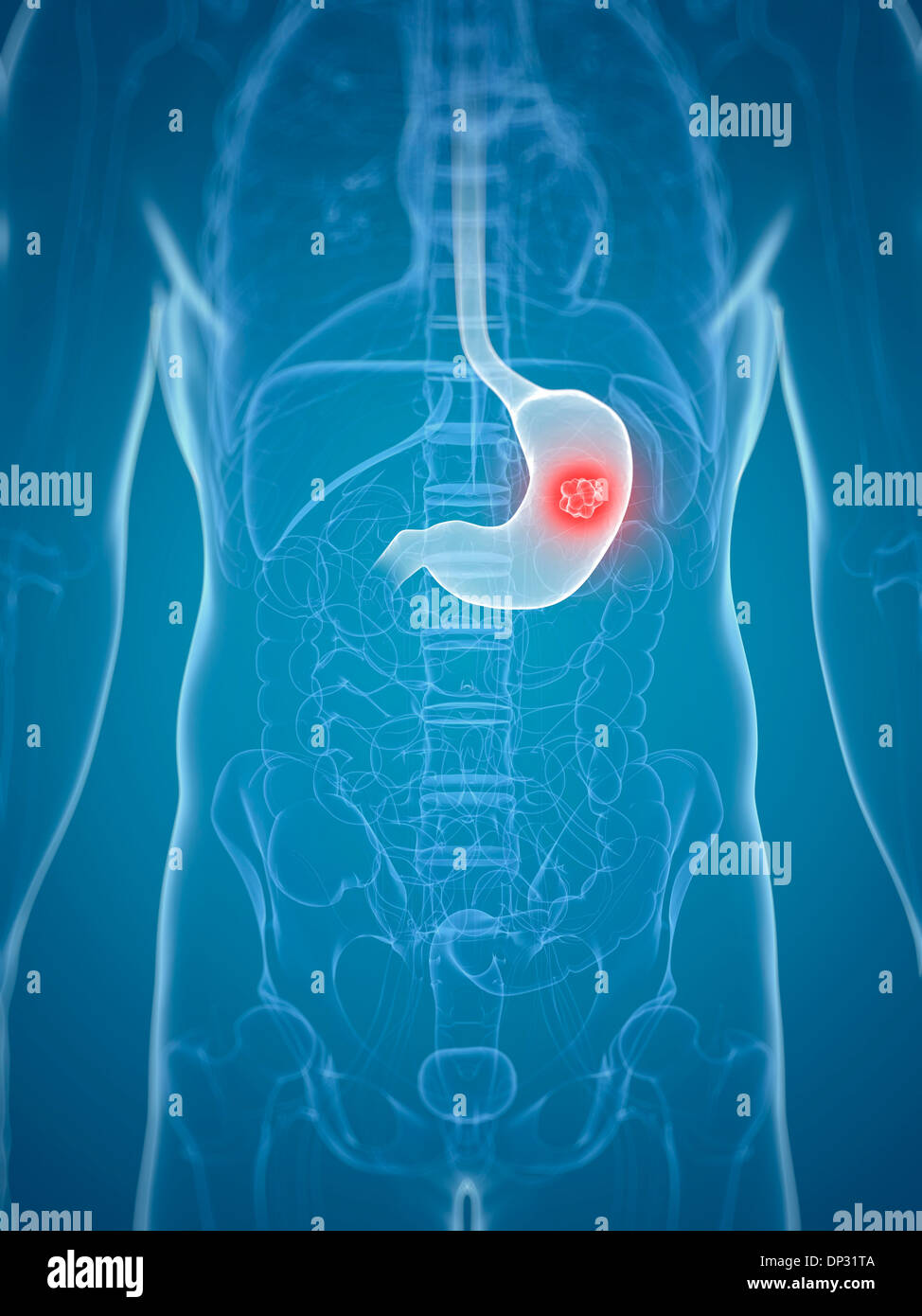 Stomach pain, artwork Stock Photo - Alamy
