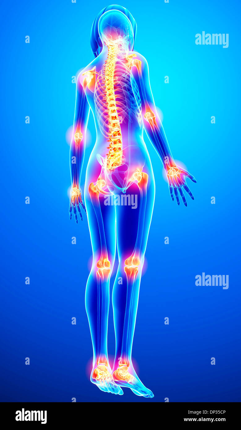 Joint pain, artwork Stock Photo - Alamy