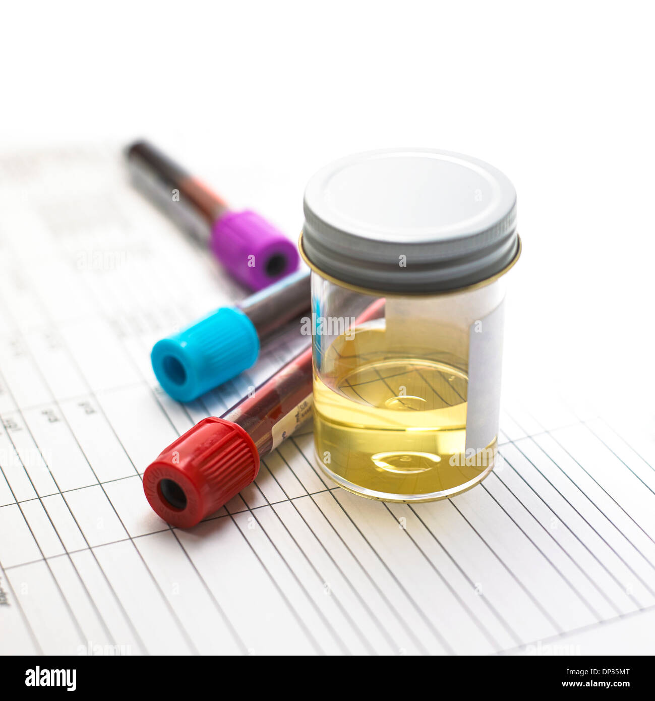 Urine and blood samples Stock Photo - Alamy