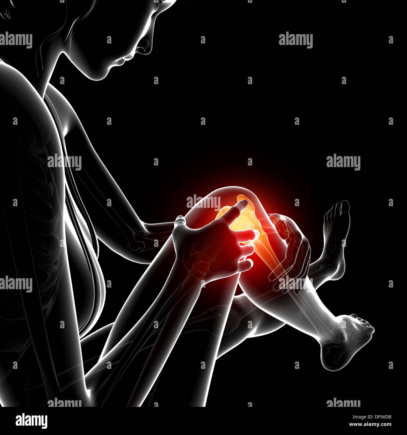 Knee pain, artwork Stock Photo - Alamy