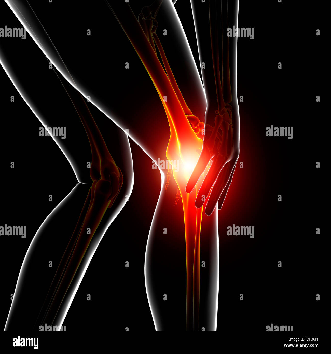 Knee pain, artwork Stock Photo - Alamy