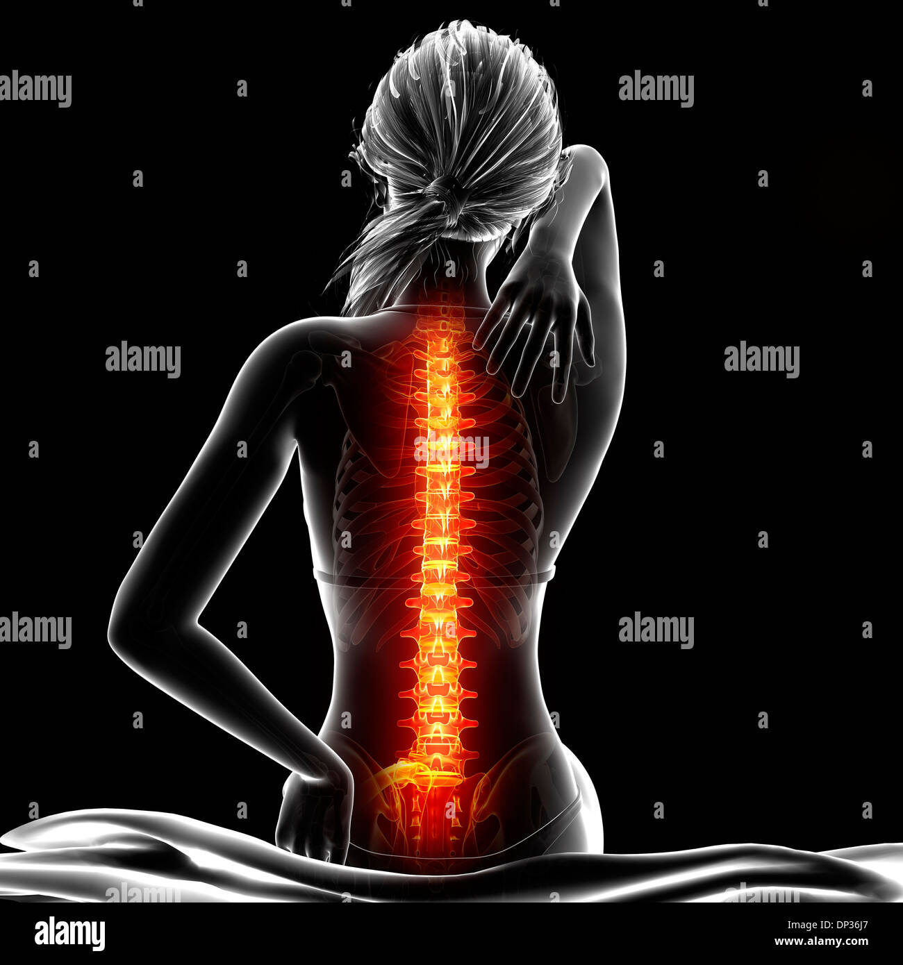 Back pain, artwork Stock Photo - Alamy
