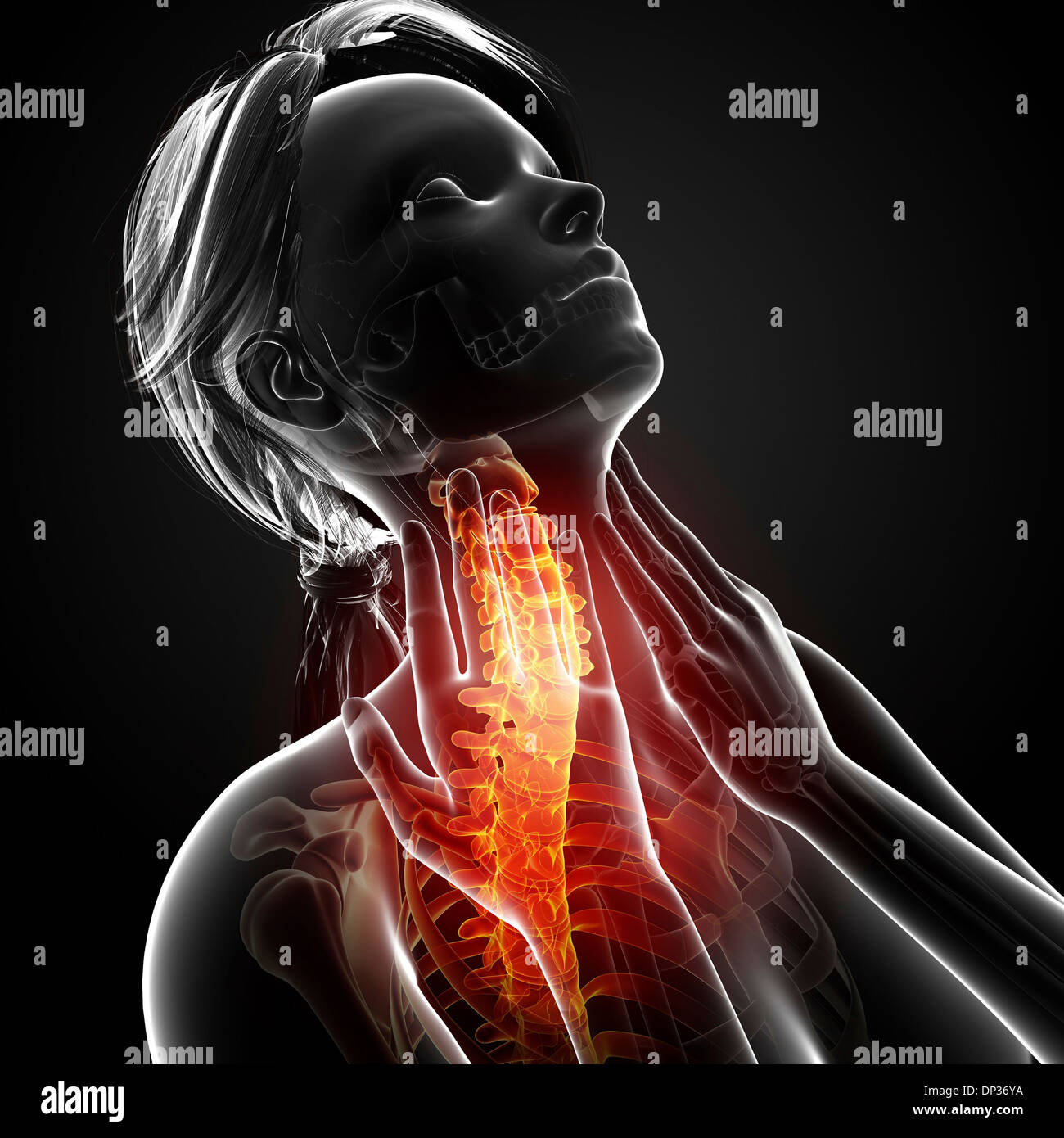 Abnormal xray of neck hi-res stock photography and images - Alamy
