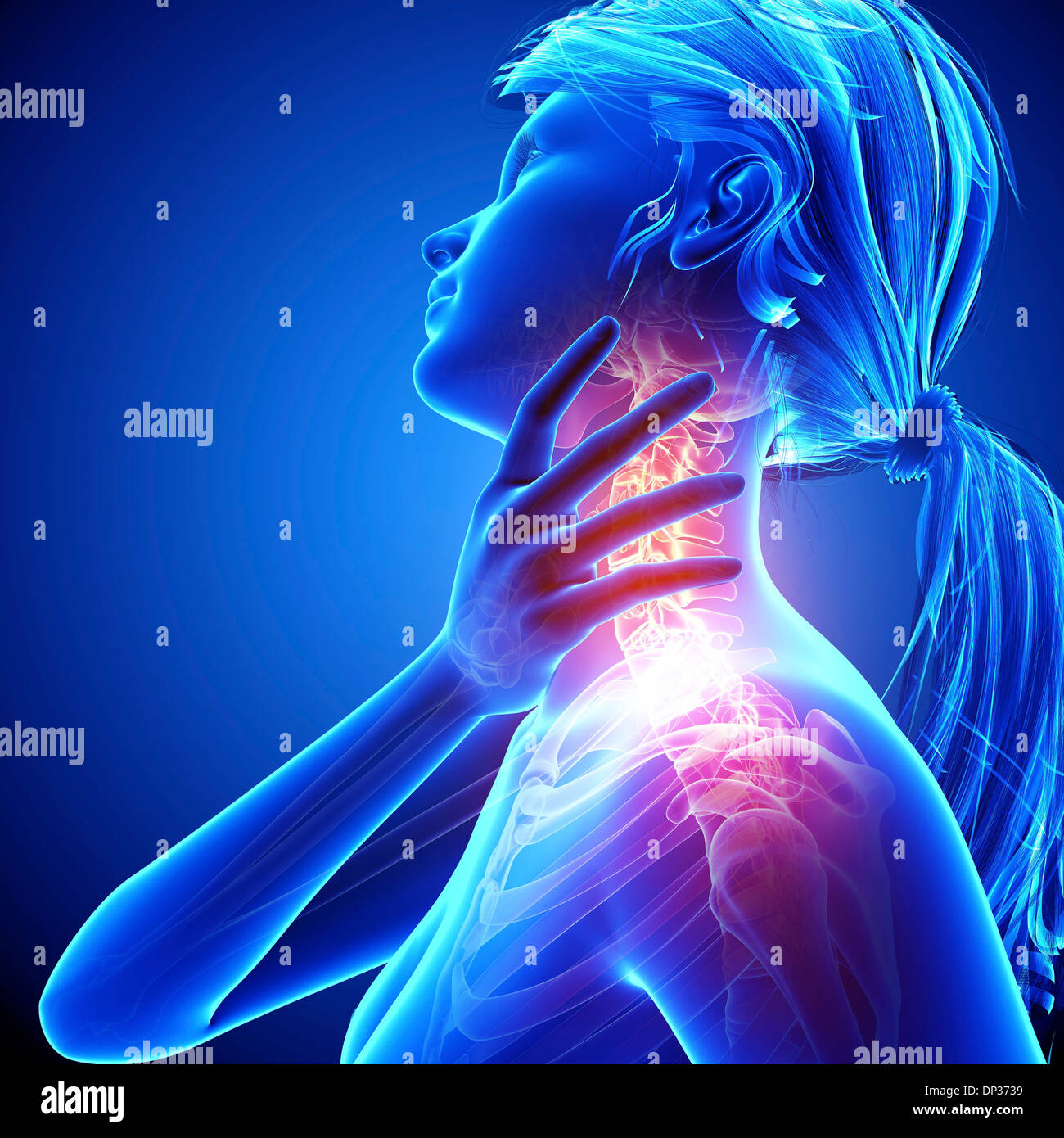 Neck pain, artwork Stock Photo - Alamy