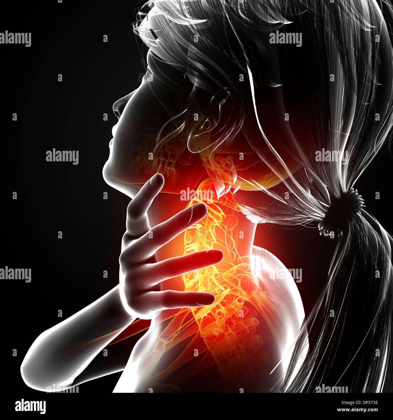 Abnormal xray of neck hi-res stock photography and images - Alamy