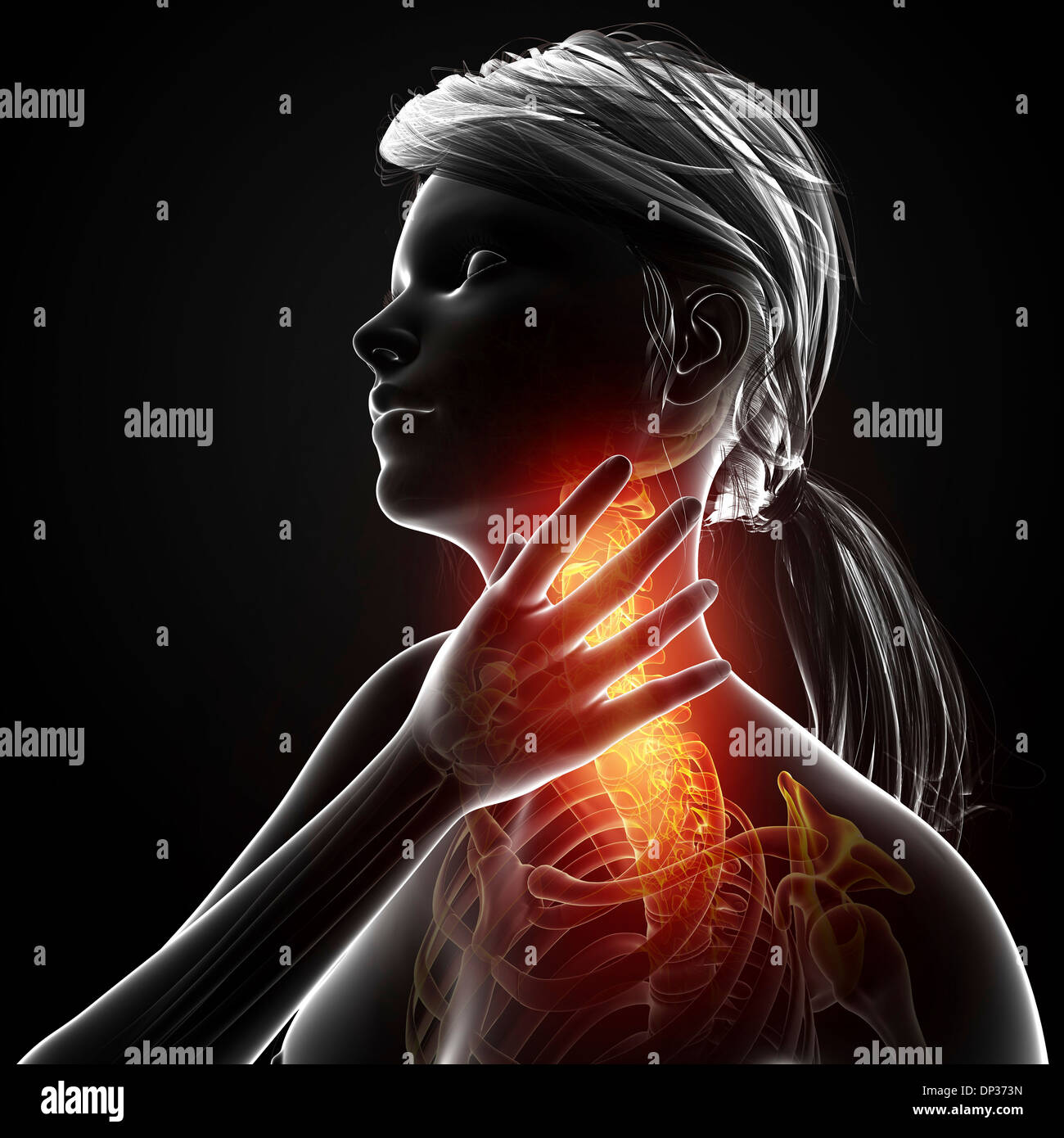 Abnormal xray of neck hi-res stock photography and images - Alamy