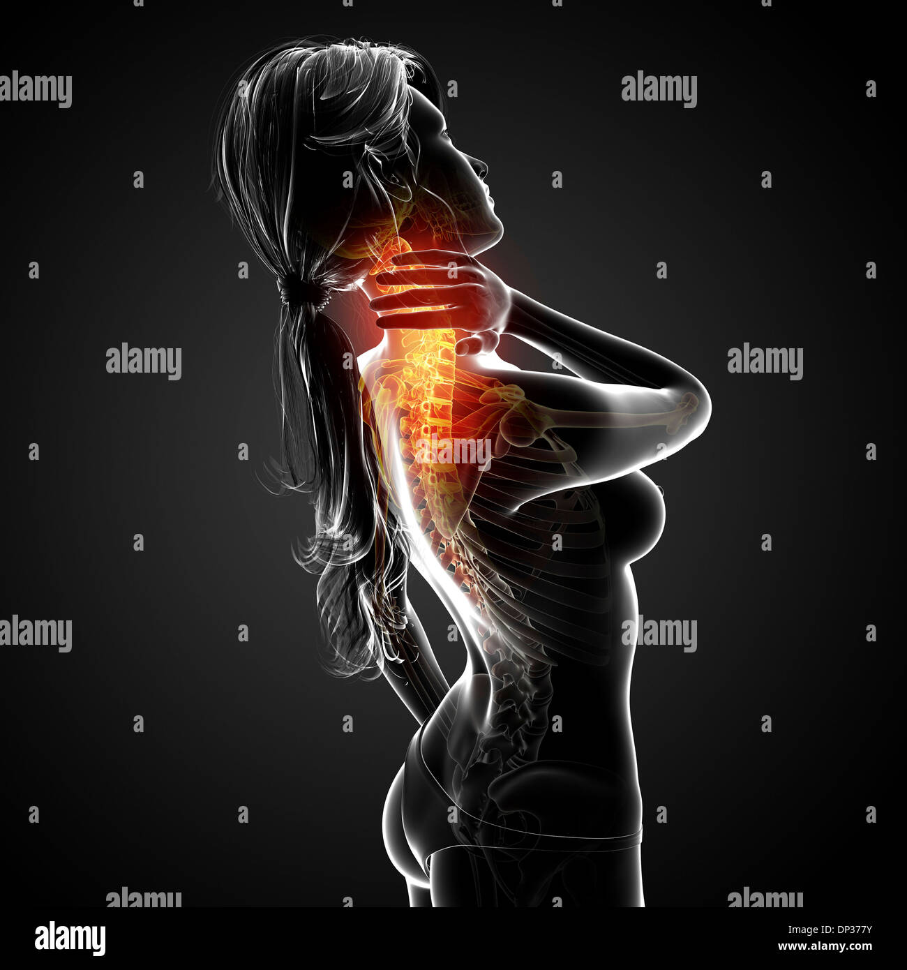 Abnormal xray of neck hi-res stock photography and images - Alamy