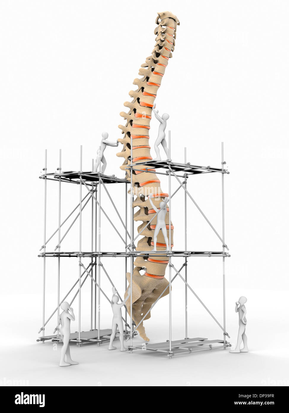 Spine with workers, spine repair Stock Photo - Alamy