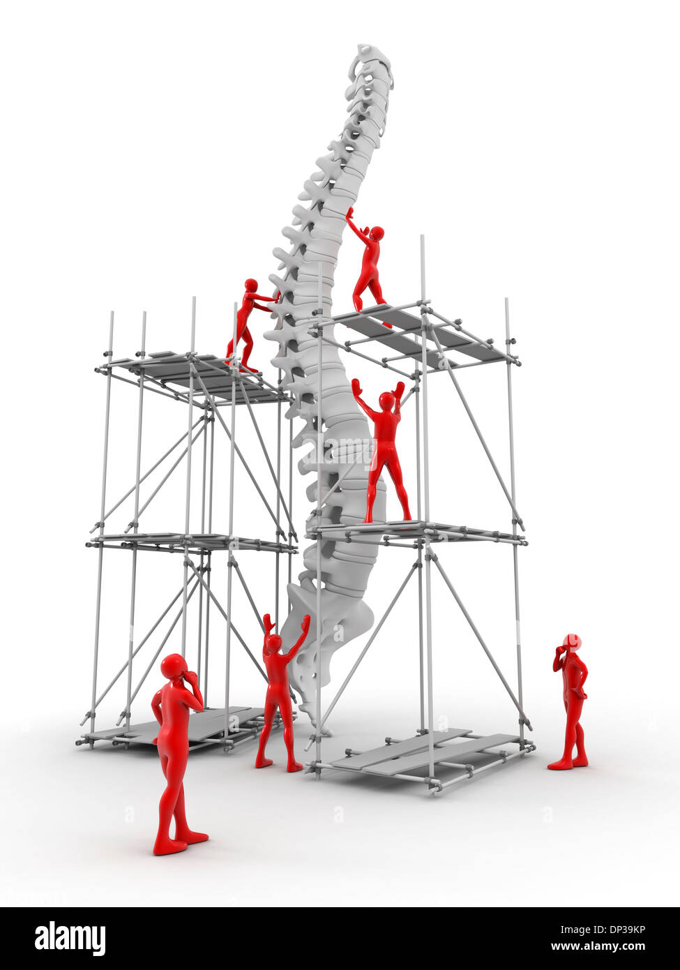 Spine with workers, spine repair Stock Photo - Alamy