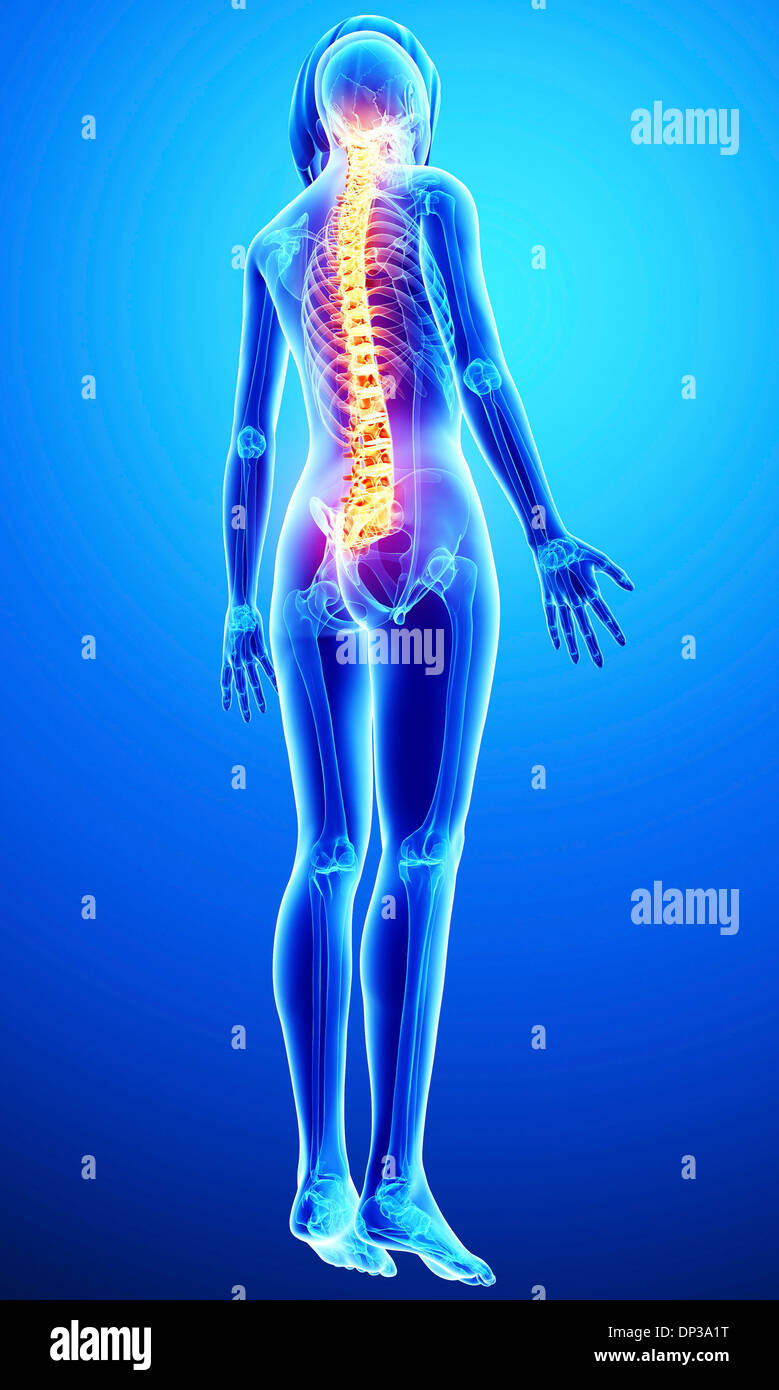 Back pain, artwork Stock Photo - Alamy