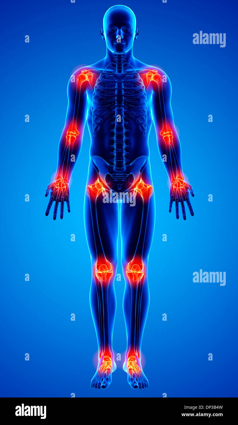 Joint pain, artwork Stock Photo - Alamy
