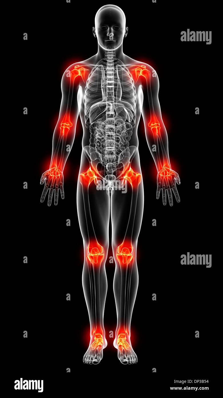 Joint pain, artwork Stock Photo - Alamy