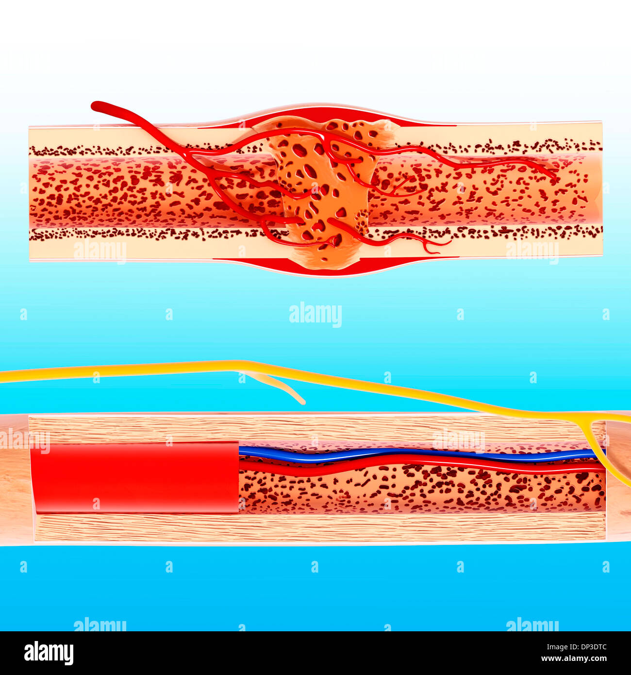 Normal bone structure hi-res stock photography and images - Alamy