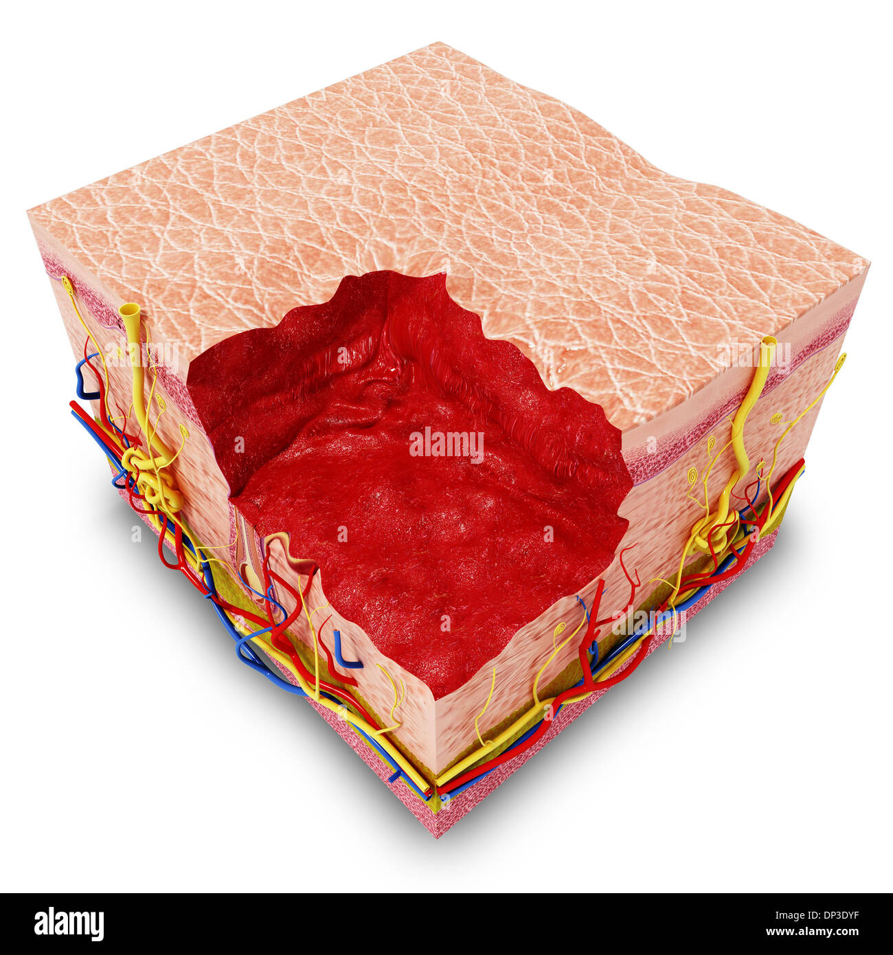 Human skin anatomy, artwork Stock Photo - Alamy