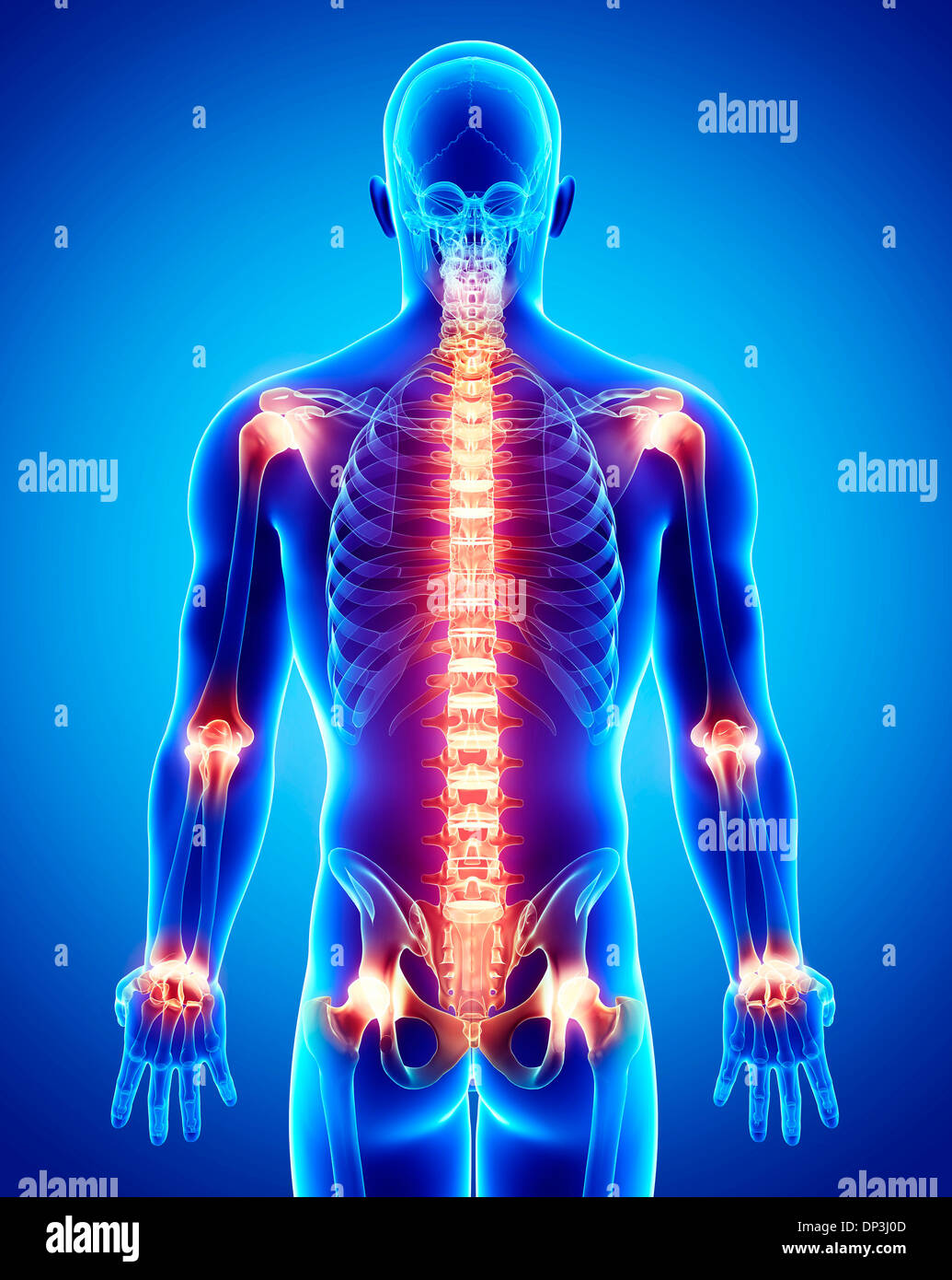 Joint pain, artwork Stock Photo - Alamy