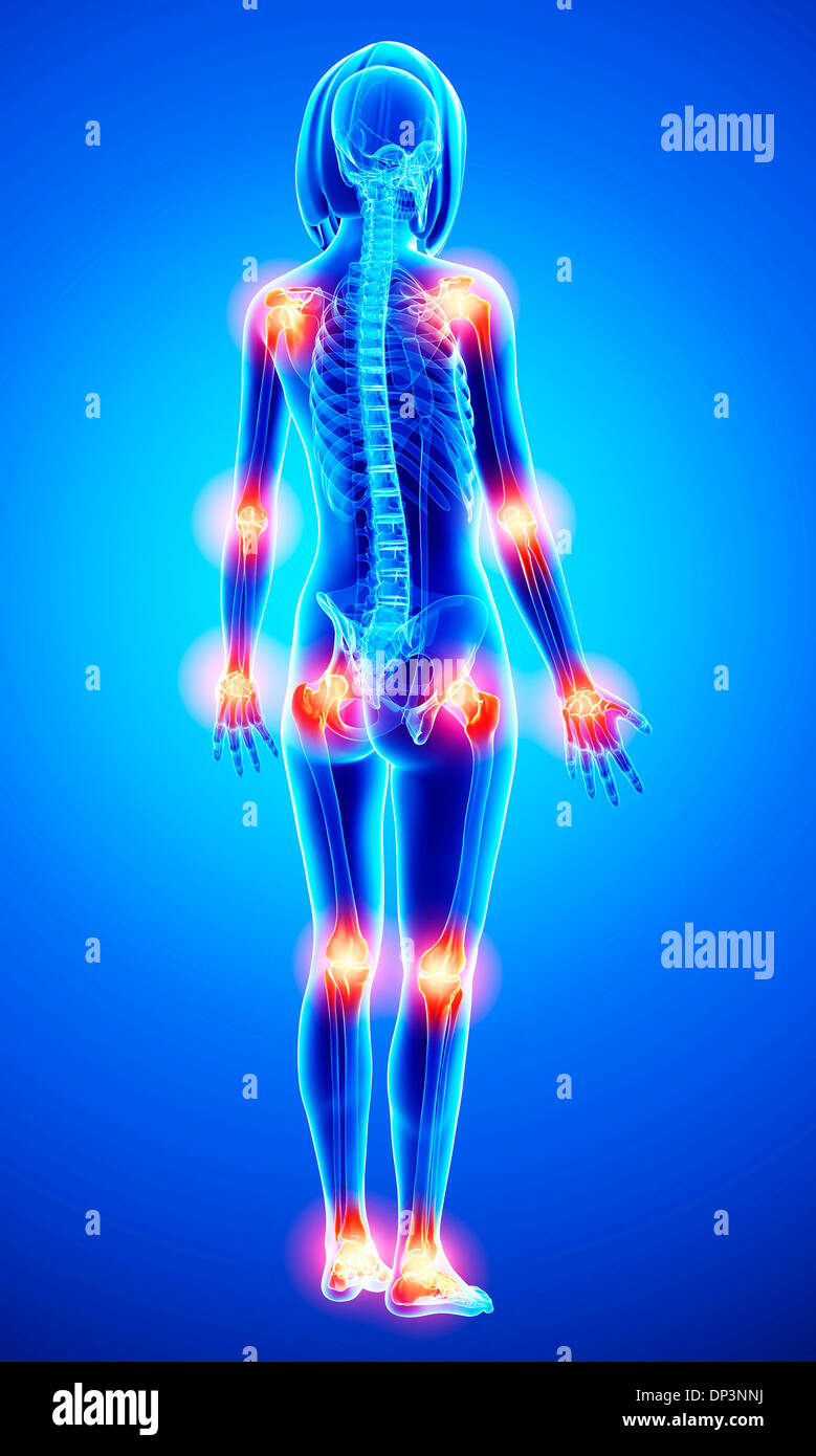 Joint pain, artwork Stock Photo - Alamy