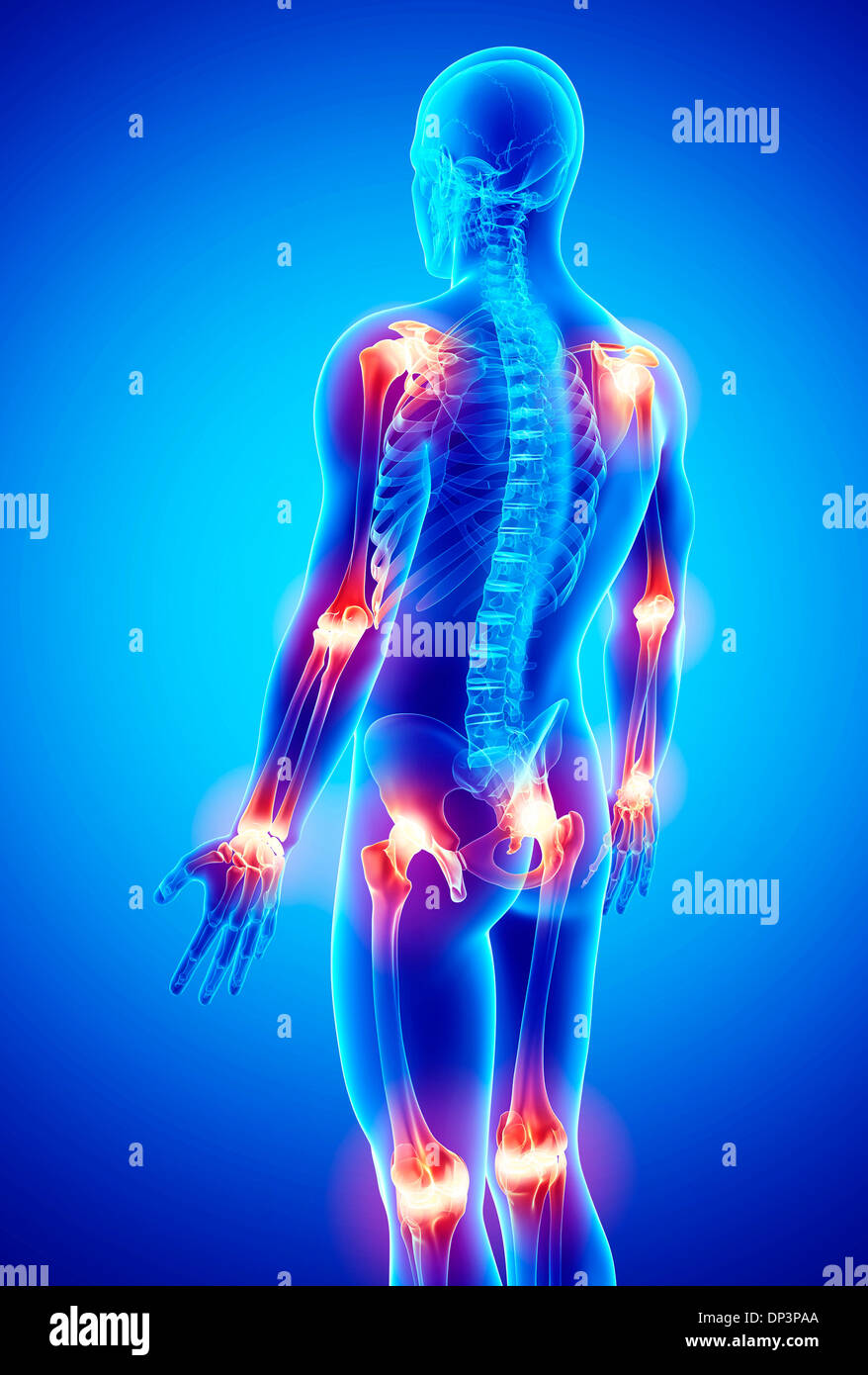 Joint pain, artwork Stock Photo - Alamy