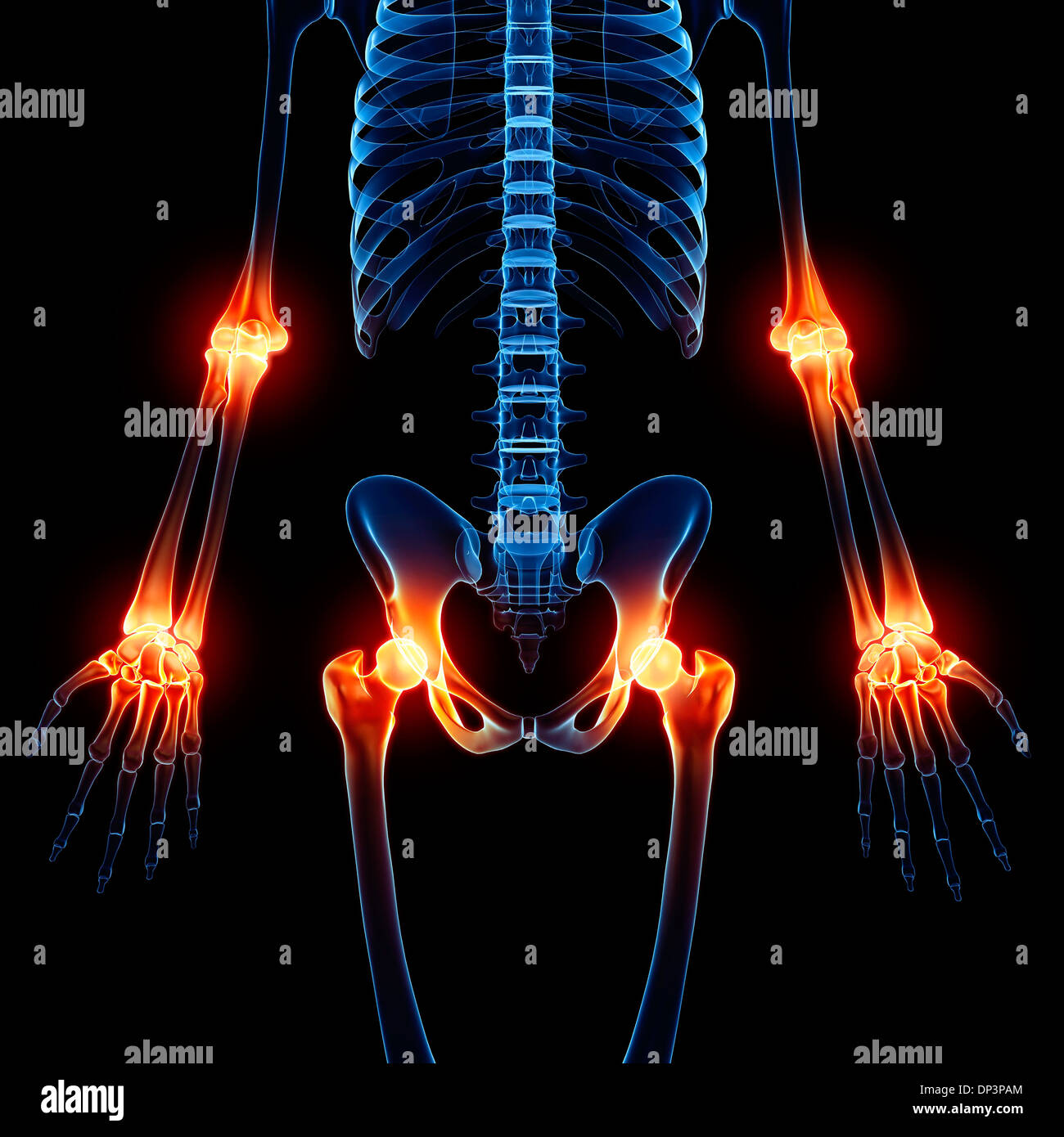 Joint pain, artwork Stock Photo - Alamy