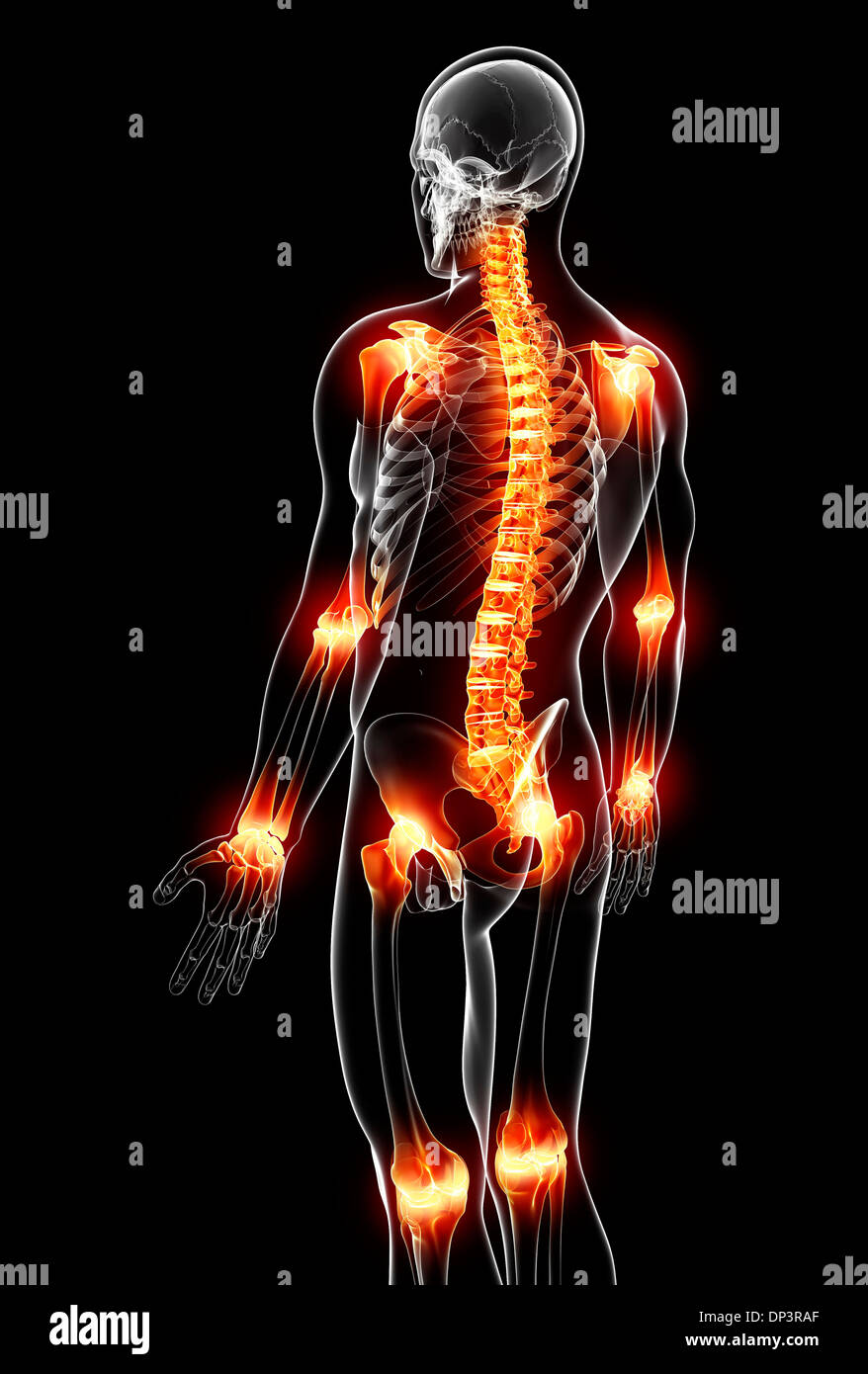 Joint pain, artwork Stock Photo - Alamy