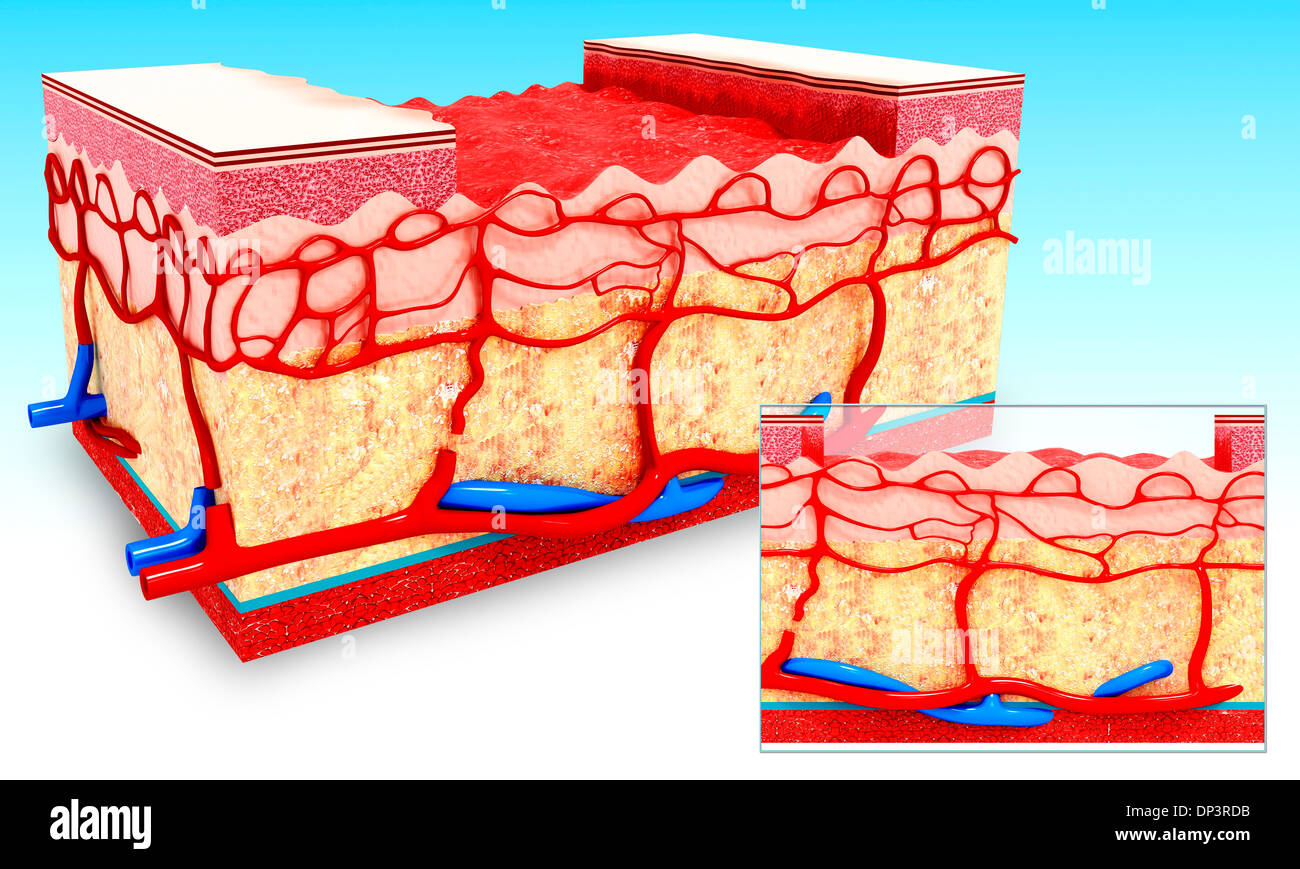 Human skin anatomy, artwork Stock Photo - Alamy