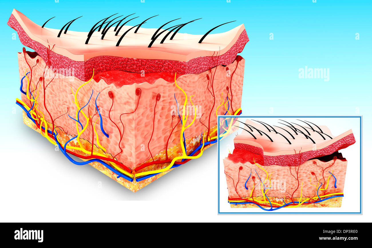 Human skin anatomy, artwork Stock Photo - Alamy