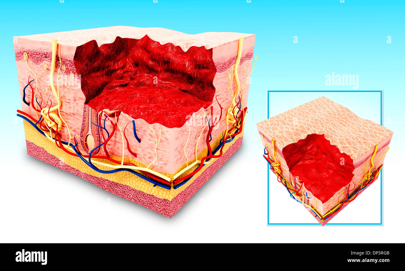 Human skin anatomy, artwork Stock Photo - Alamy