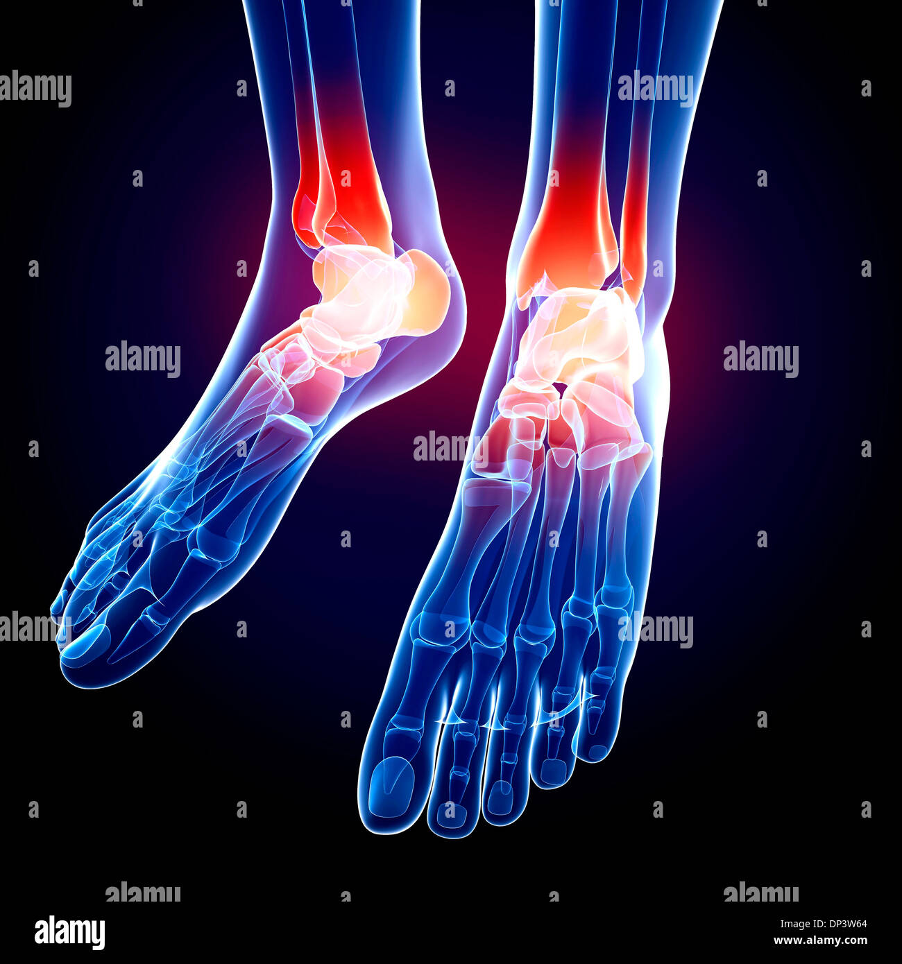 Foot pain, artwork Stock Photo - Alamy