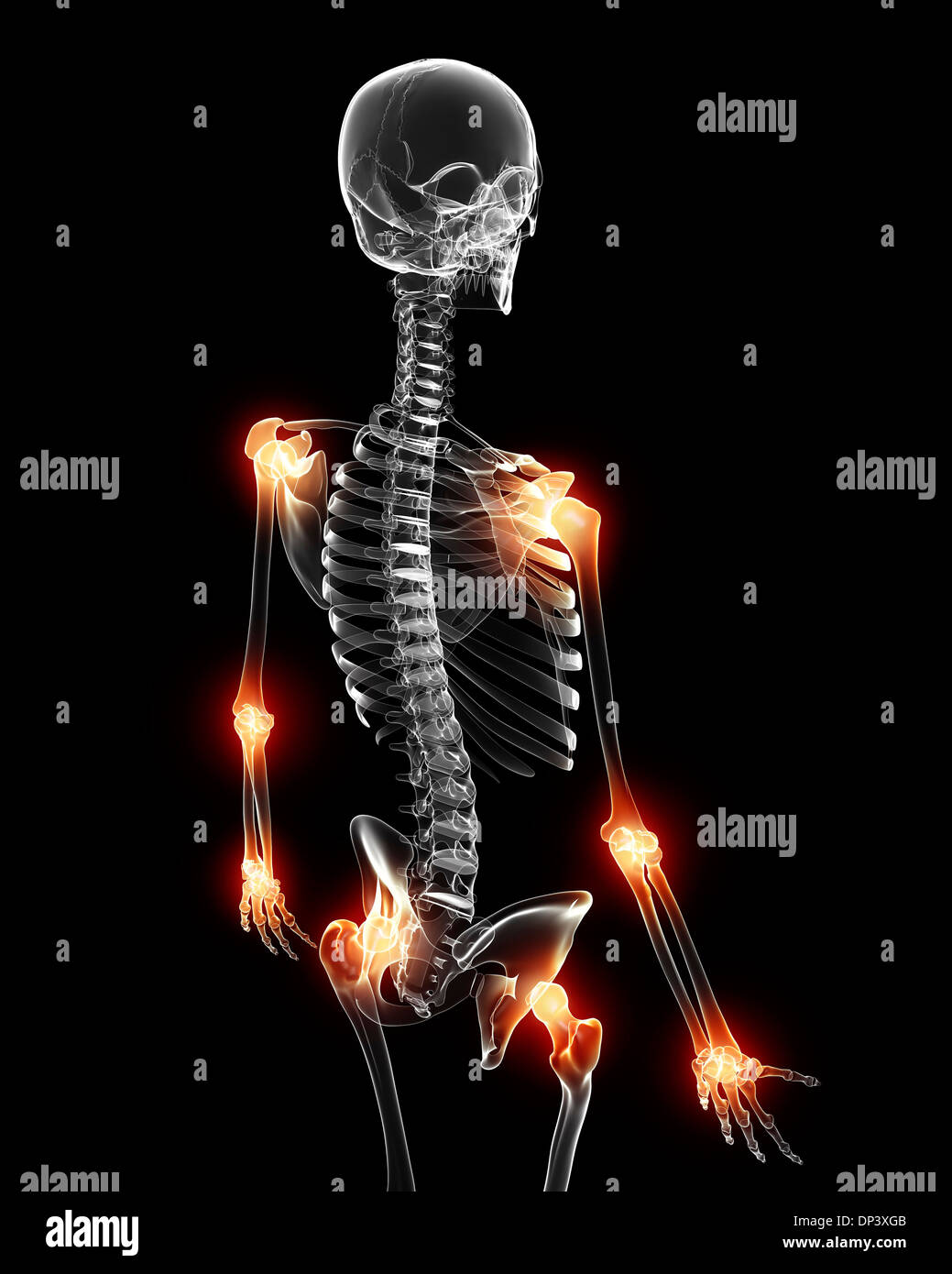 Joint pain, artwork Stock Photo - Alamy