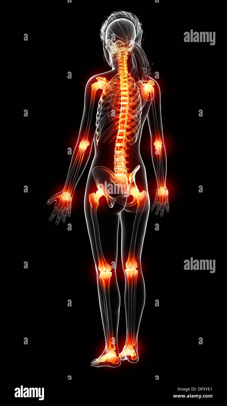 Joint pain, artwork Stock Photo - Alamy